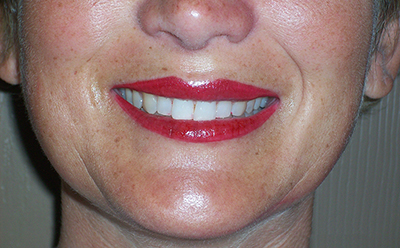 Kim's Permanent Cosmetics | Photo Gallery | Permanent Cosmetics