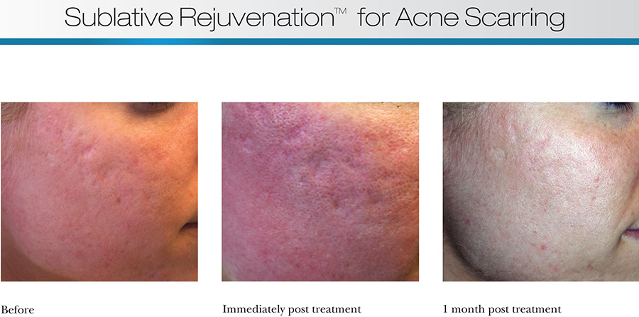 Kim's Permanent Cosmetics | Photo Gallery | Permanent Cosmetics | Laser ...